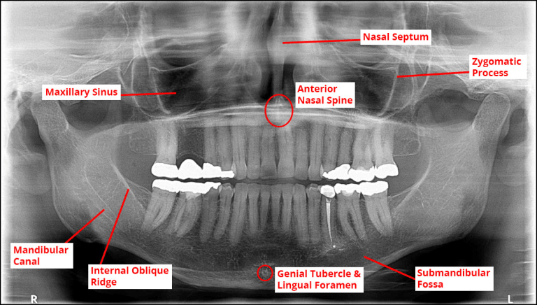 Radiology: X-Ray positions | DentMistry