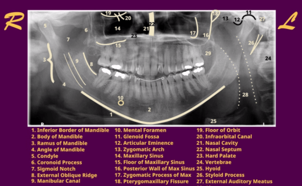 Radiology: X-Ray positions | DentMistry